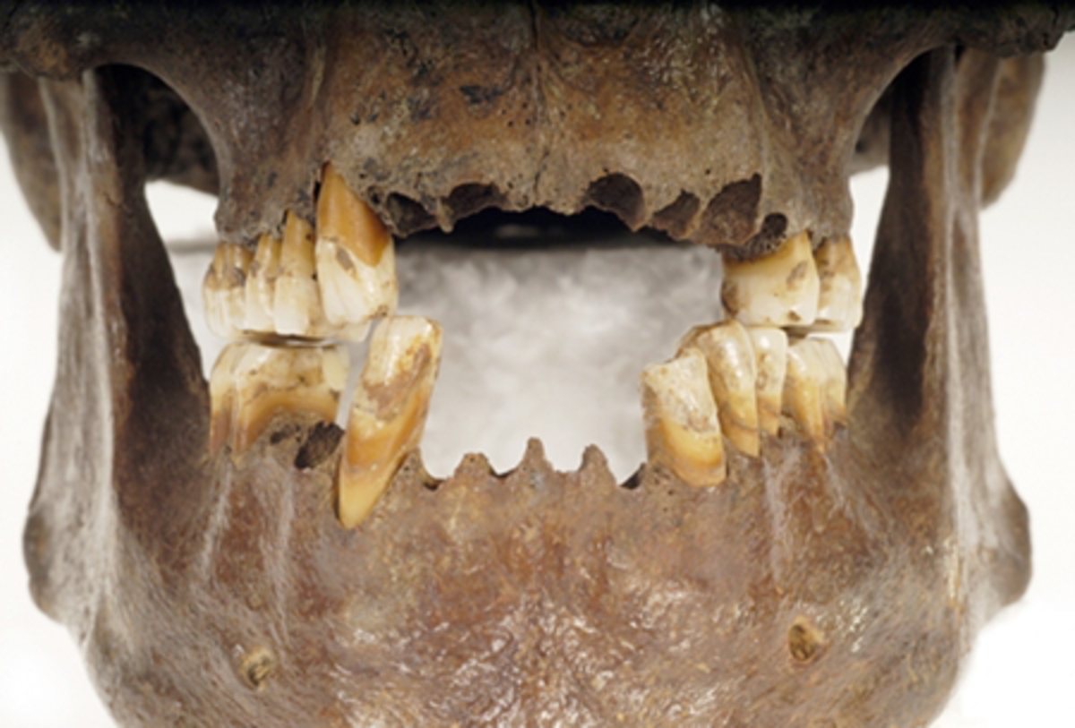 Kranium - Vasamuseet / DigitaltMuseum